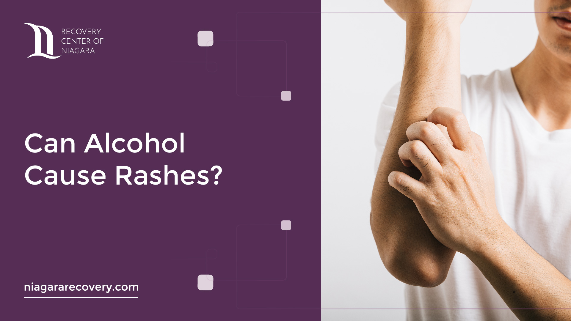 Can Alcohol Cause Rashes?